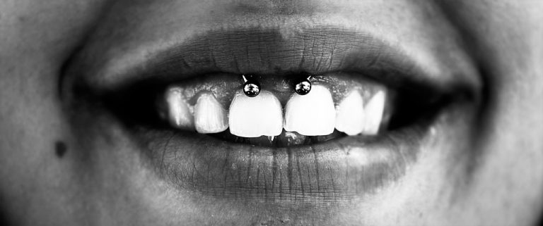 Las consecuencias de llevar piercings en la boca | Dibujando Sonrisas Sanas